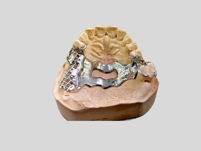 ksbdentures